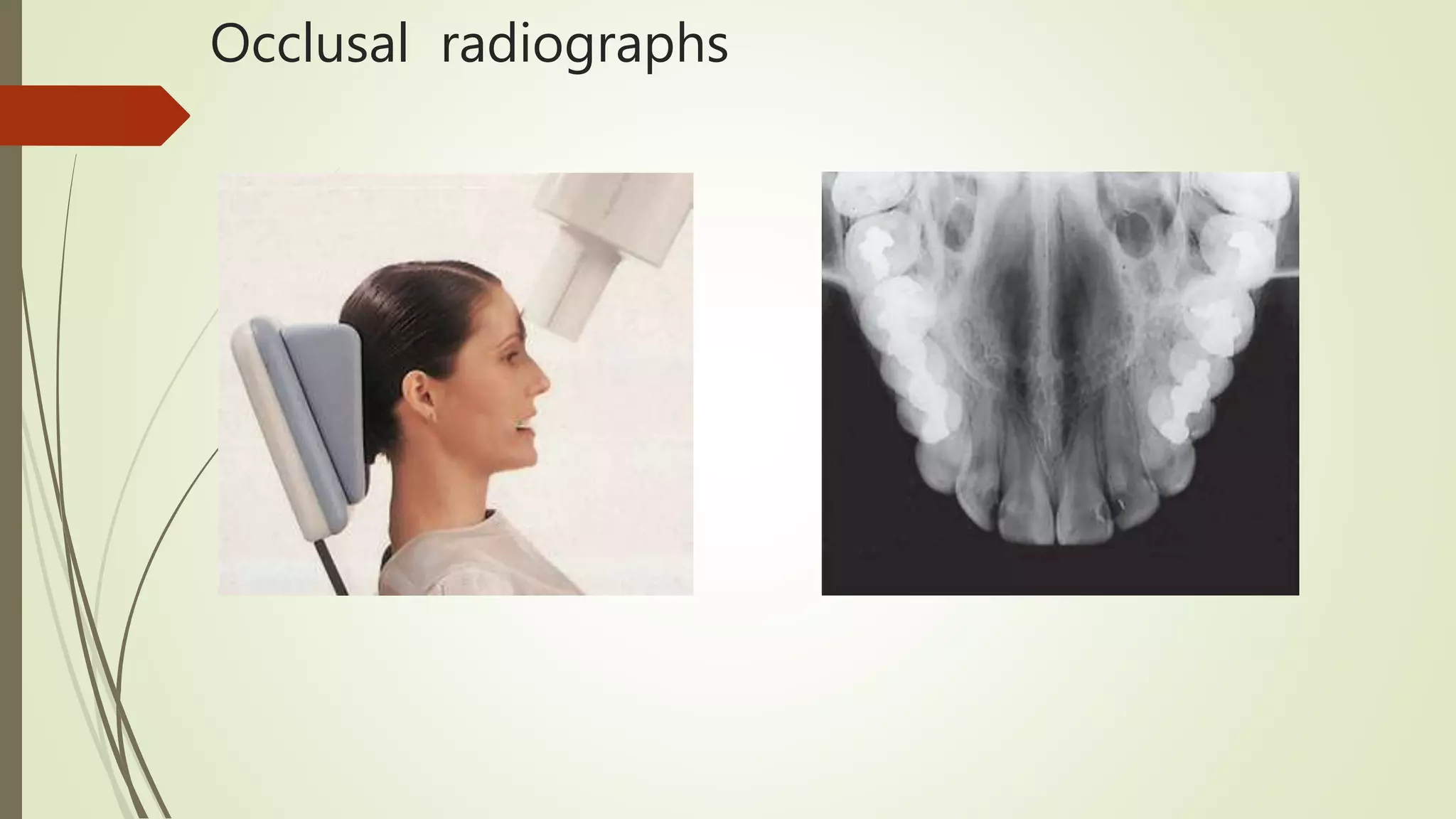 Maxillofacial radiology | PPTX