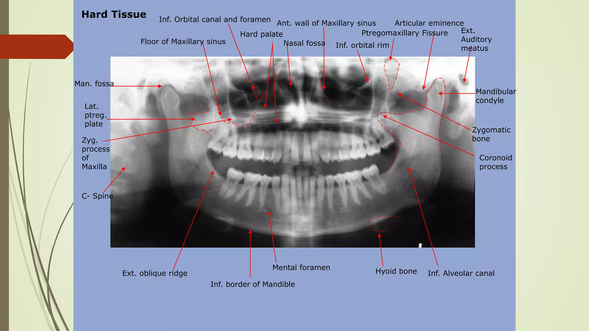 Maxillofacial radiology | PPTX