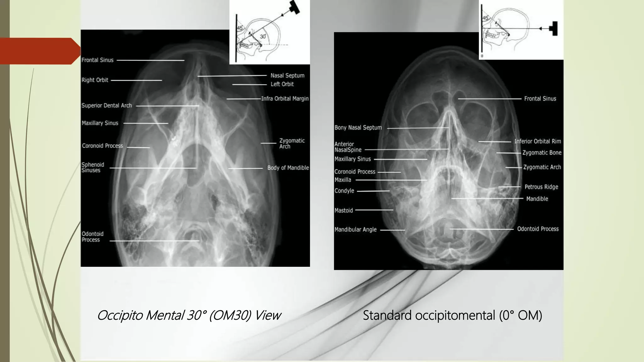 Maxillofacial radiology | PPTX