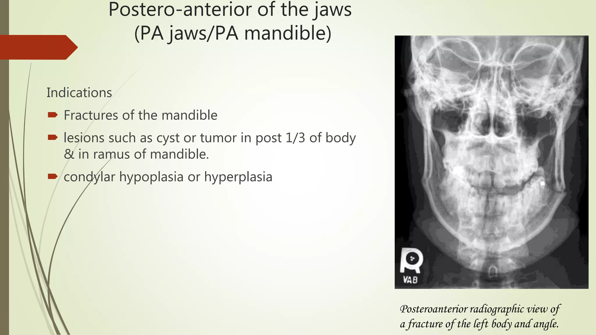 Maxillofacial radiology | PPTX