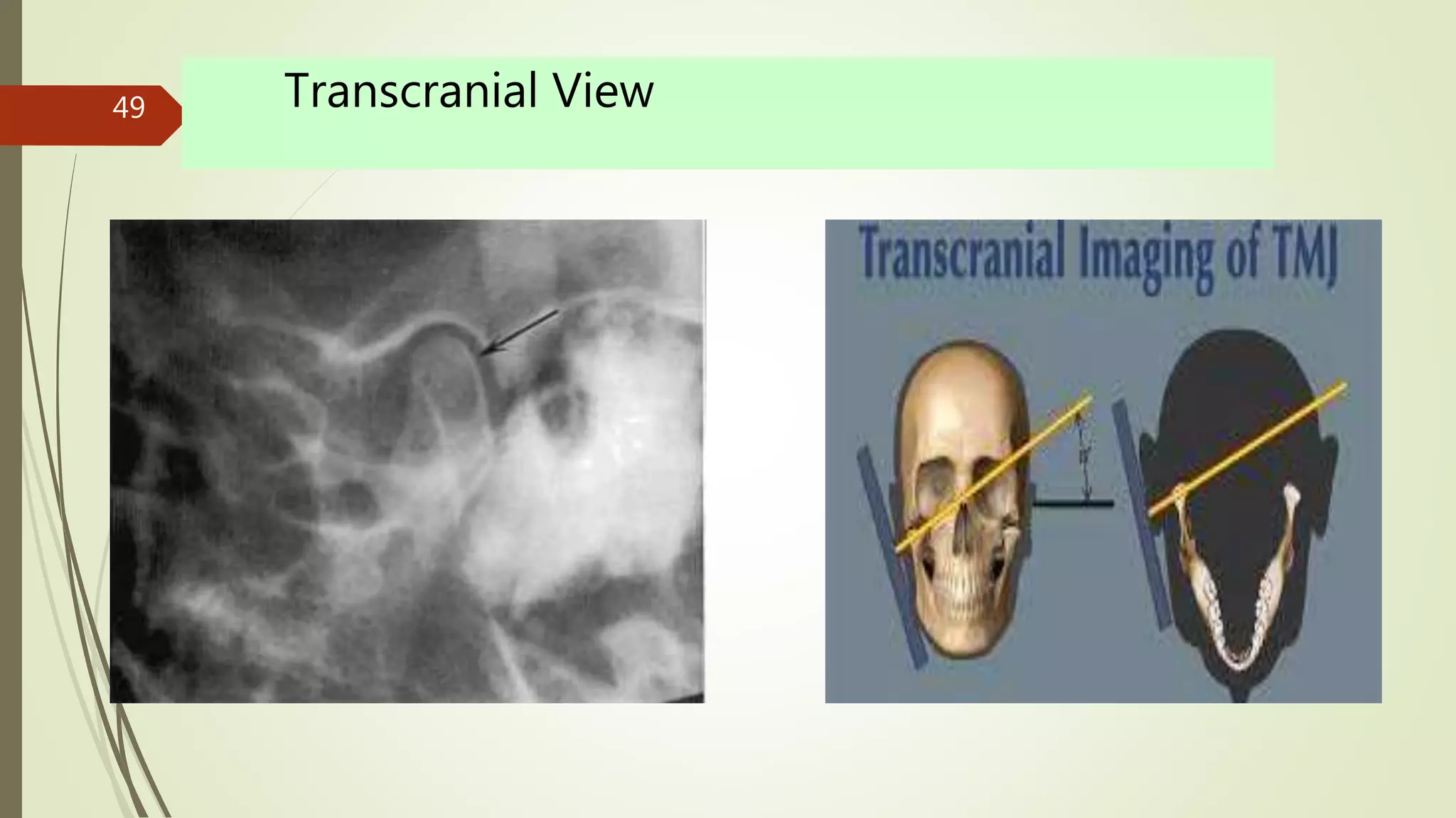 Maxillofacial radiology | PPTX