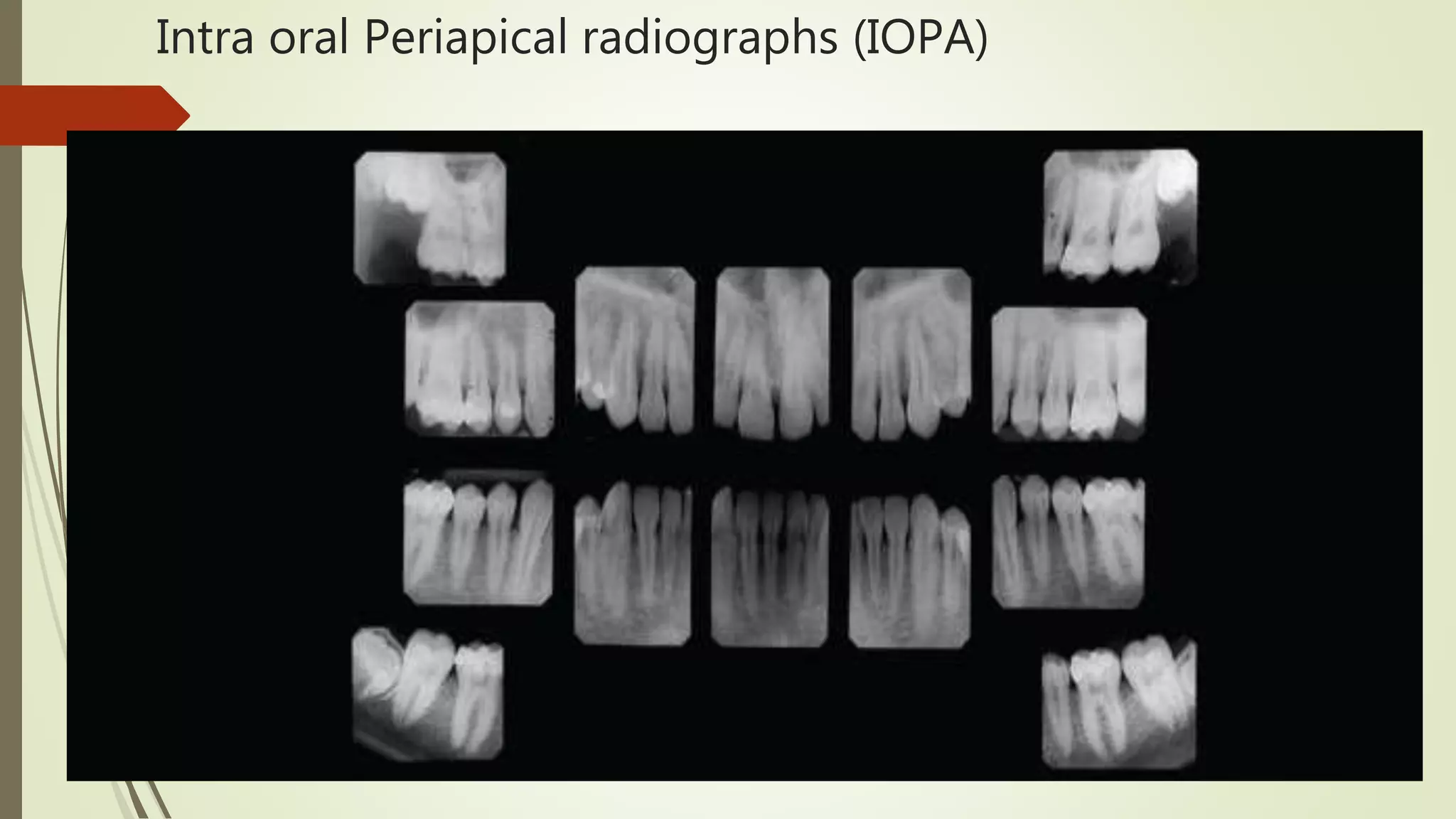 Maxillofacial radiology | PPTX