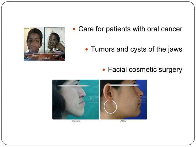 Maxillofacial surgery | PPT