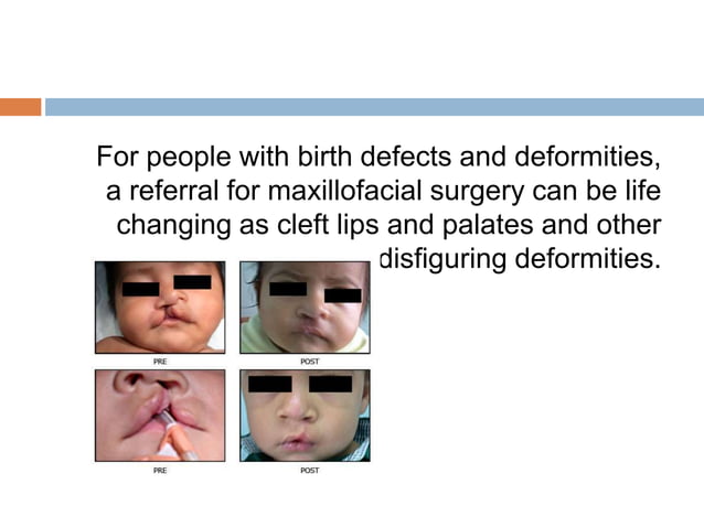 Maxillofacial surgery | PPTX | Dental Health | Diseases and Conditions