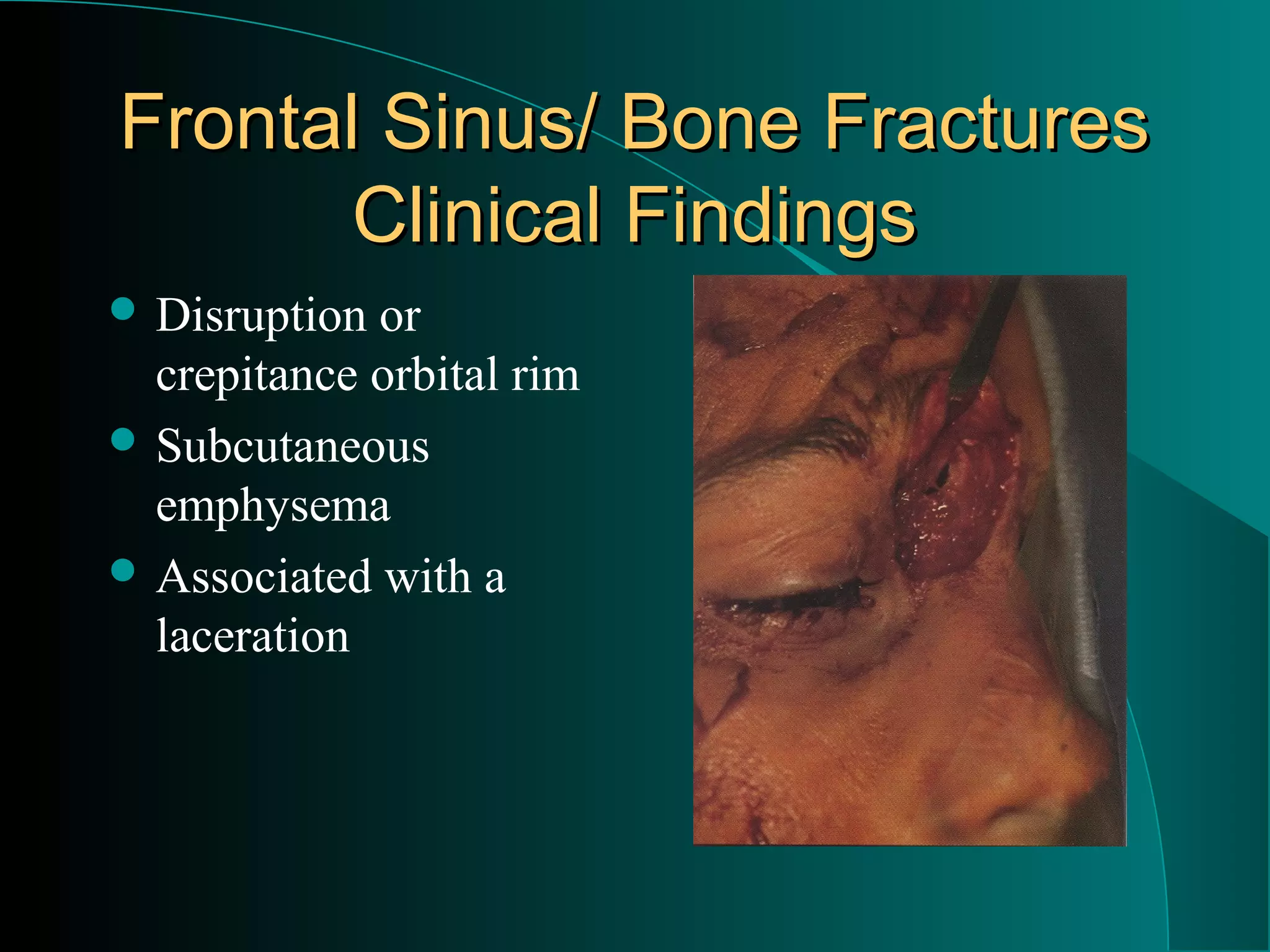 Maxillofacial trauma | PPT