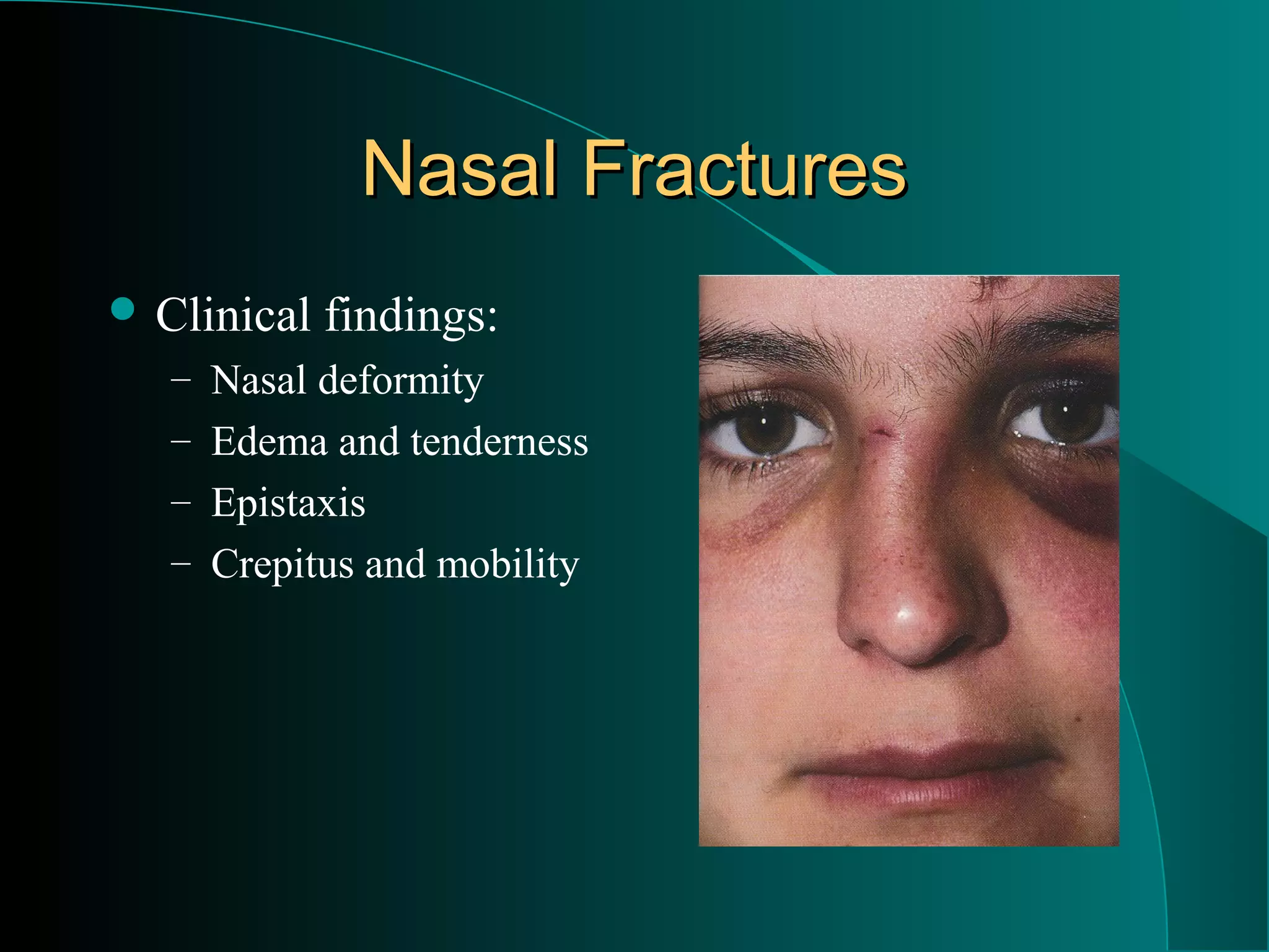Maxillofacial trauma | PPT