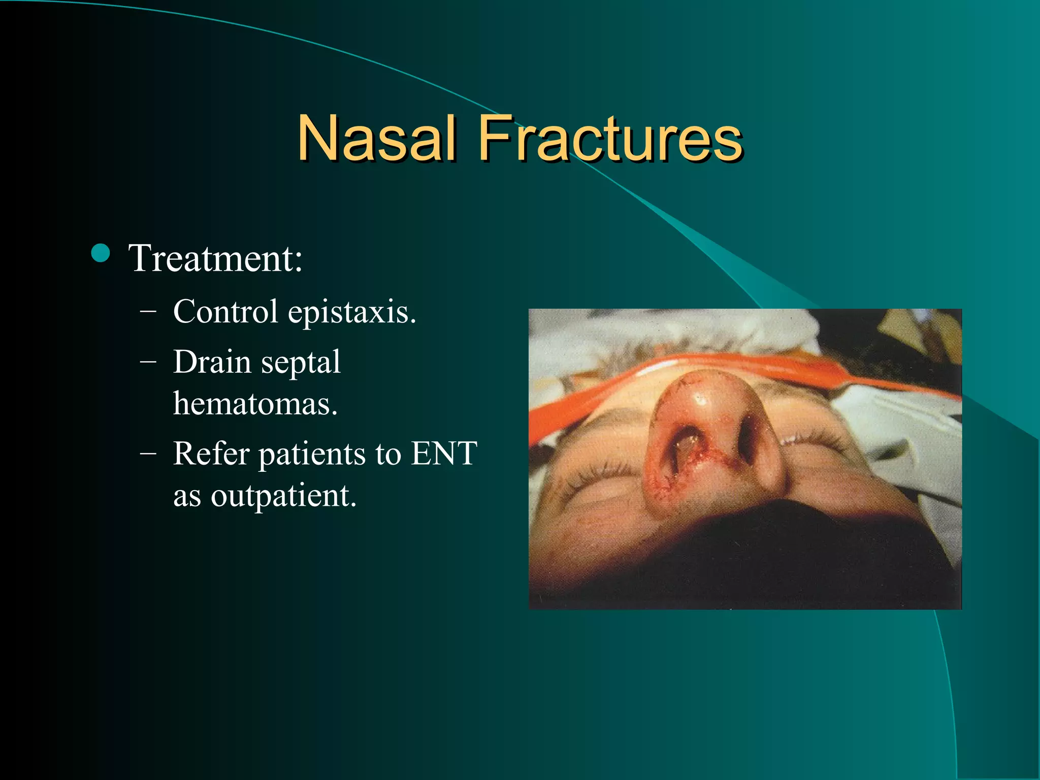 Maxillofacial trauma | PPT