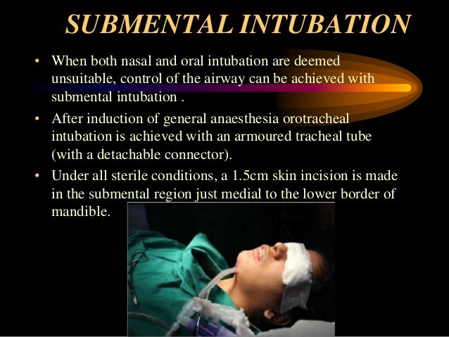 Maxillofacial trauma