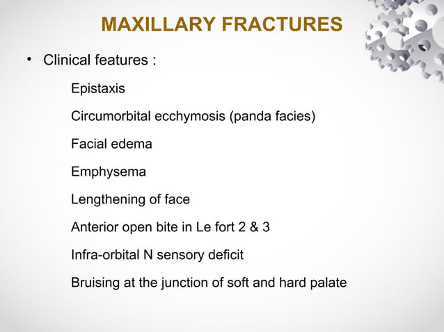 Maxillo facial trauma | PPT