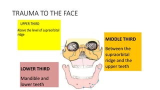 Maxillo facial trauma | PPT
