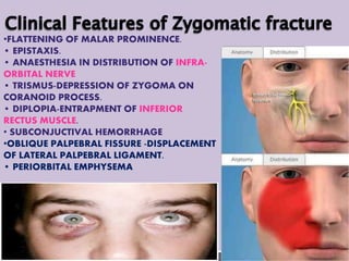 maxillofacialtrauma-copy-150708102907-lva1-app6891.pdf