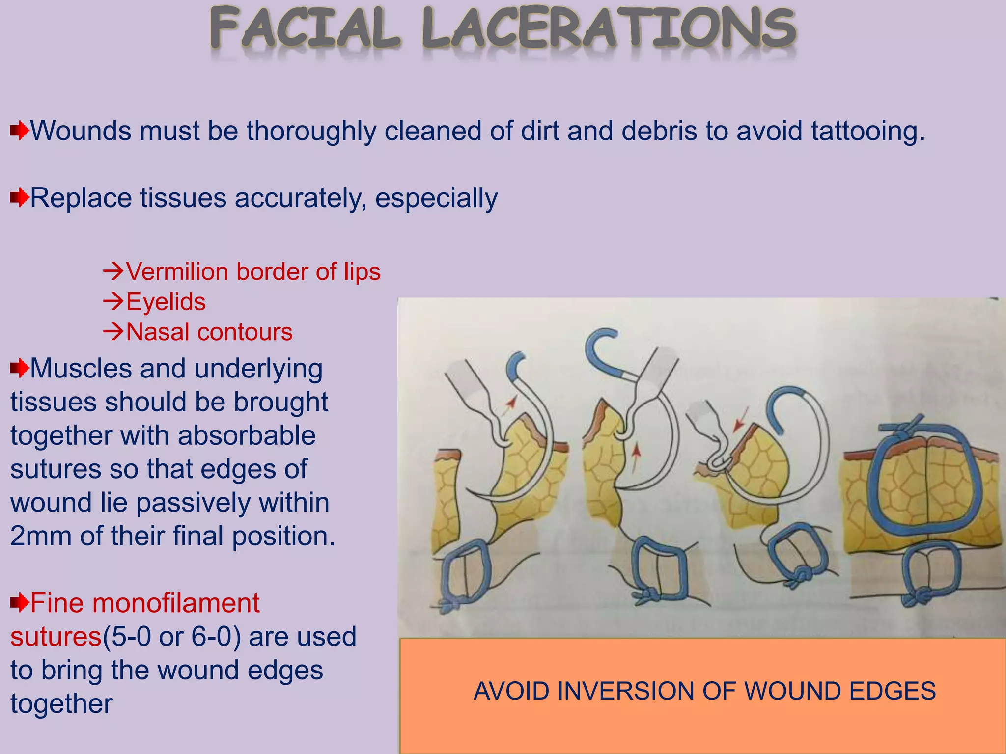 MAXILLO FACIAL TRAUMA (Bailey and Love) | PPTX