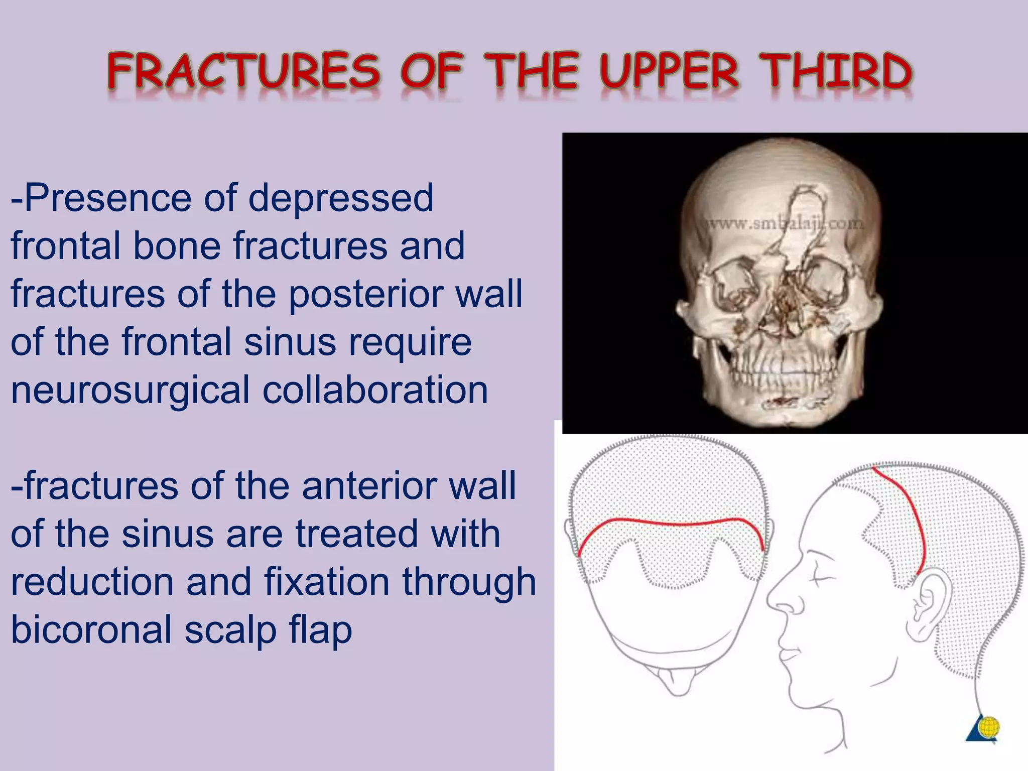 MAXILLO FACIAL TRAUMA (Bailey and Love) | PPTX