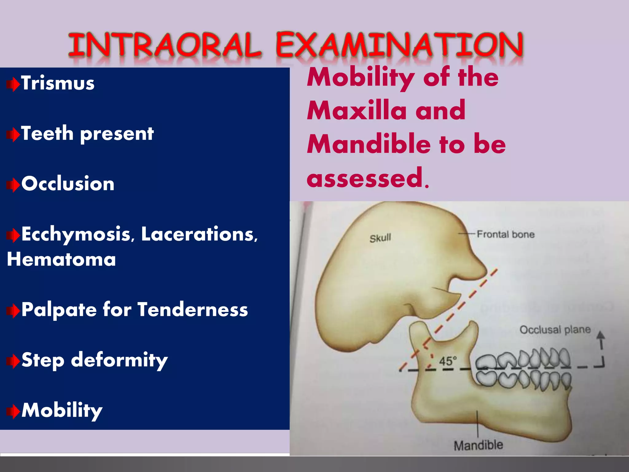 MAXILLO FACIAL TRAUMA (Bailey and Love) | PPTX