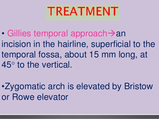 MAXILLO FACIAL TRAUMA (Bailey and Love)