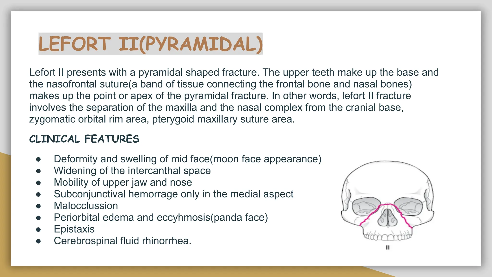 MAXILLOFACIAL TRAUMA presented by doctor shamma | PDF