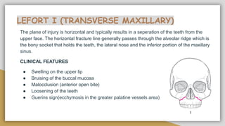 MAXILLOFACIAL TRAUMA presented by doctor shamma | PDF