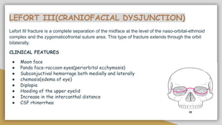 MAXILLOFACIAL TRAUMA presented by doctor shamma | PDF