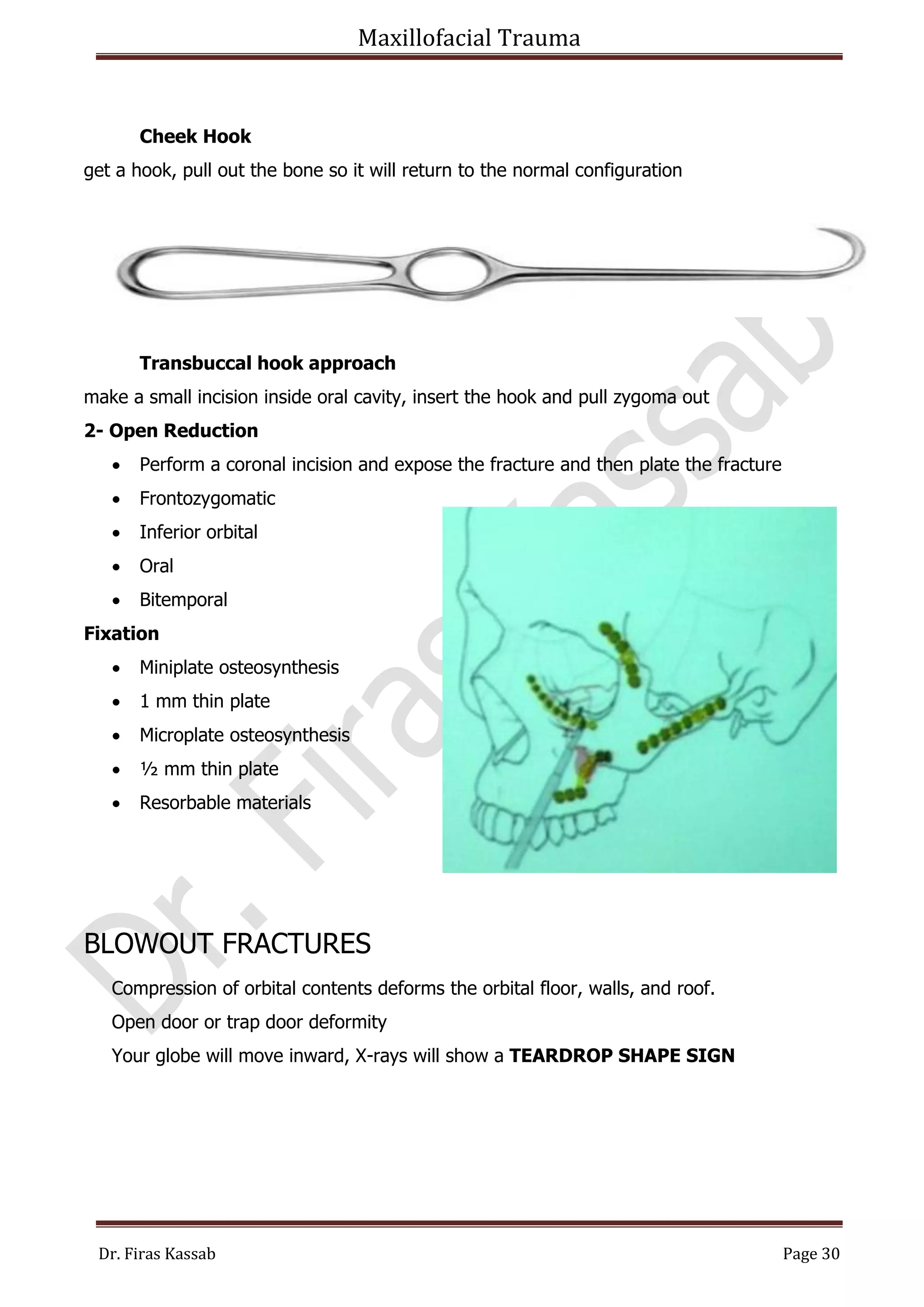 Maxillofacial trauma 2 | PDF