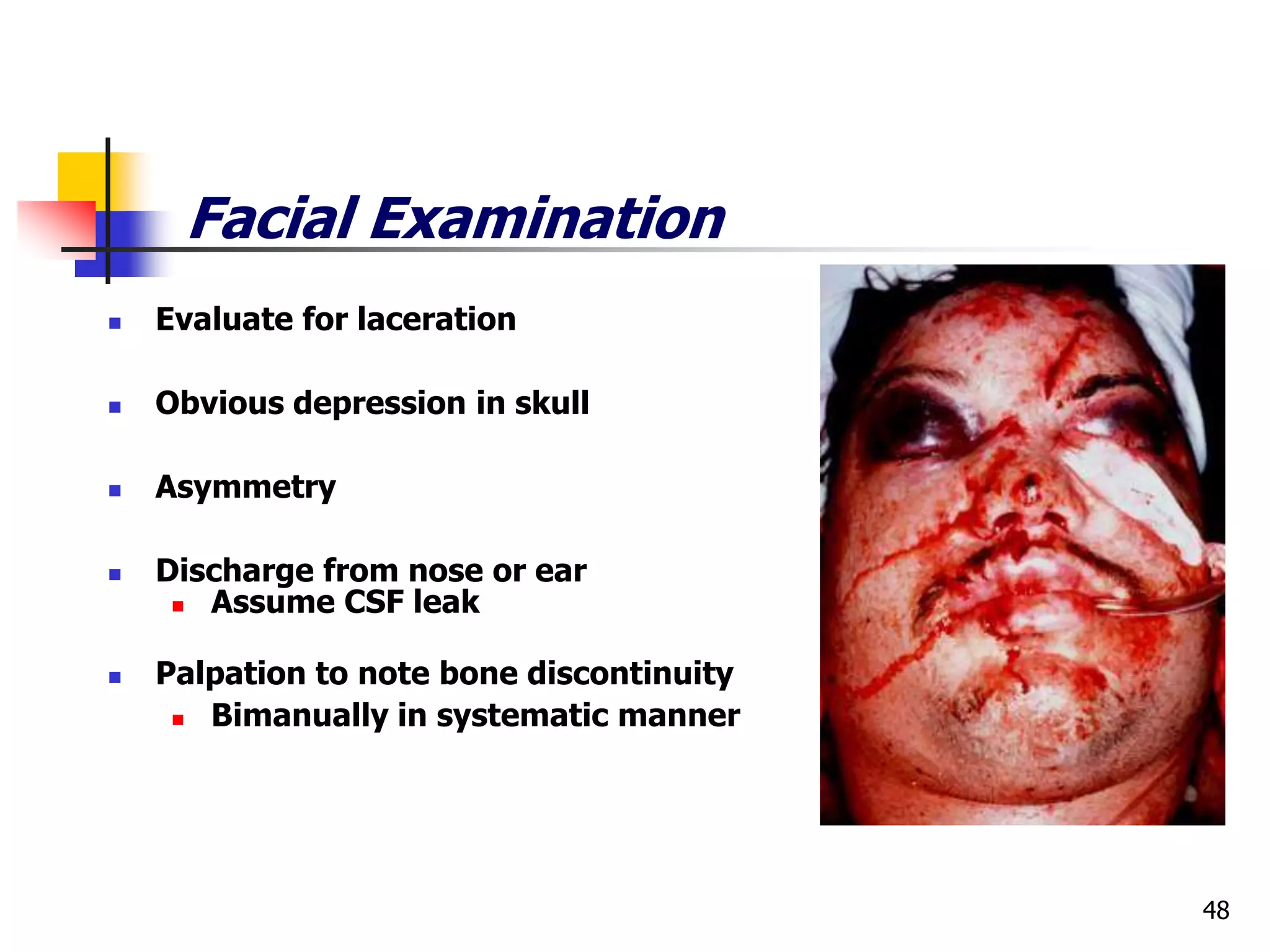Maxillofacial Trauma emergency management.ppt