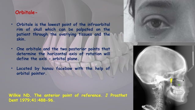 MAXILLO MANDIBULAR RELATIONS IN COMPLETE DENTURE PROSTHODONTICS | PPTX
