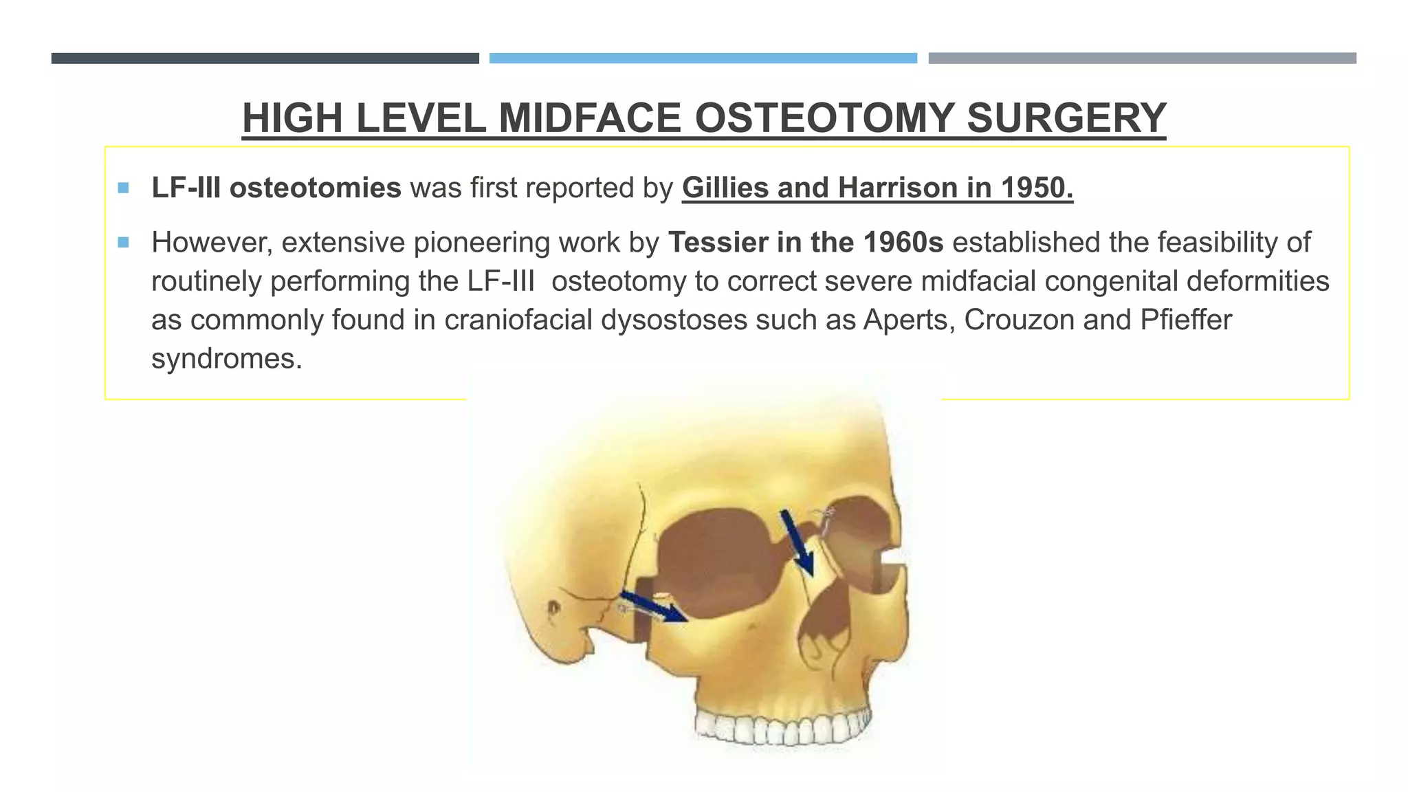MAXILLRY OSTEOTOMY.pptx