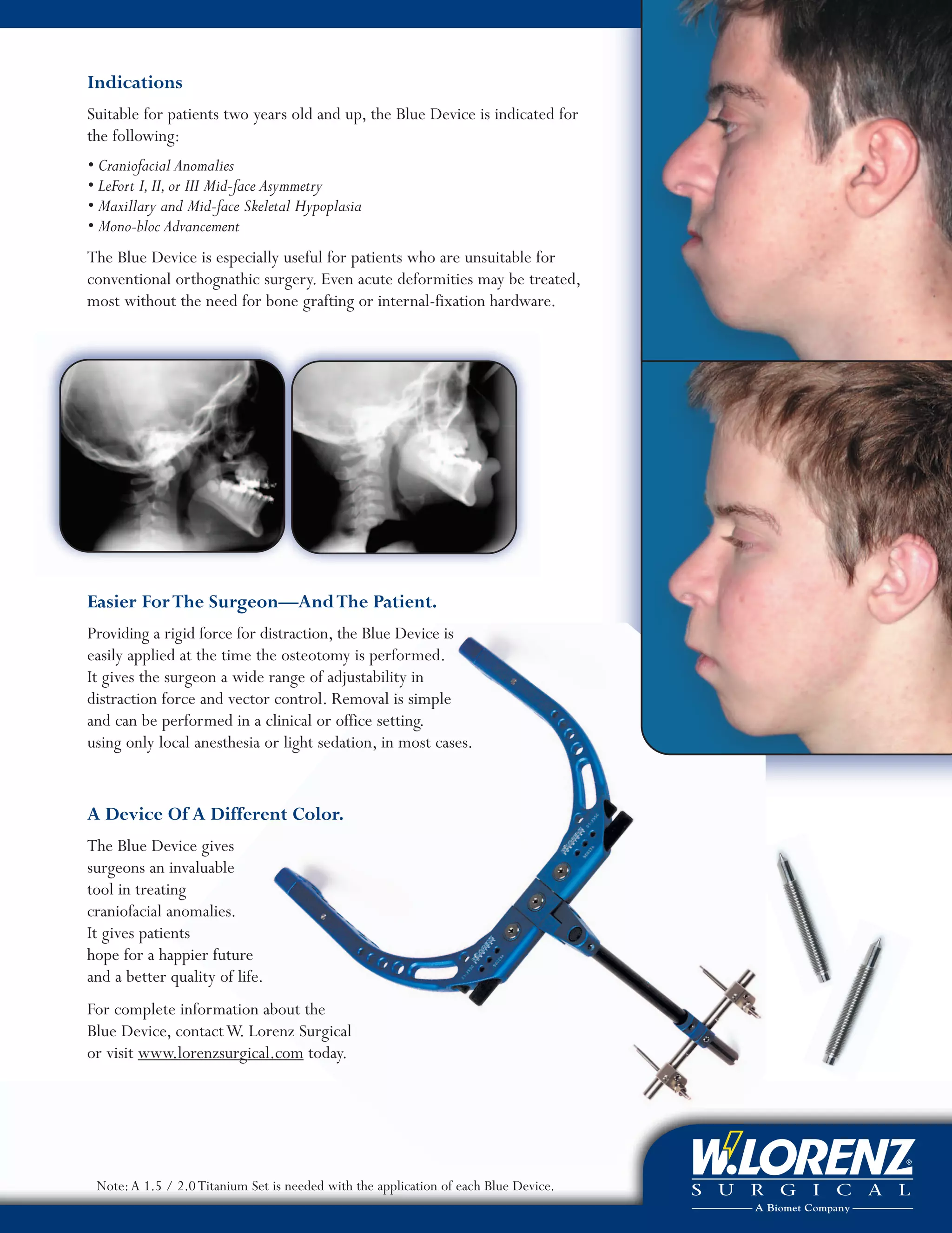 Maxilo Facial dos | PDF
