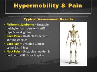 Hypermobility and the Danger of Stretching | PPTX