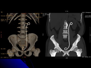 Maximum intensity projection (mip) (2) | PPT | Medical Tests | Medical ...