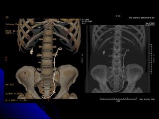 Maximum intensity projection (mip) (2) | PPT | Medical Tests | Medical ...