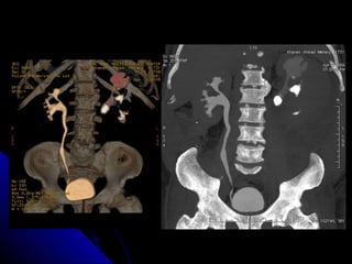 Maximum intensity projection (mip) (2) | PPT