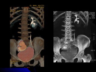 Maximum intensity projection (mip) (2) | PPT | Medical Tests | Medical ...