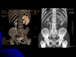 Maximum intensity projection (mip) (2) | PPT | Medical Tests | Medical ...