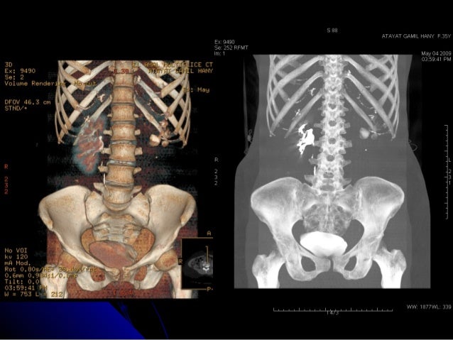 Maximum intensity projection (mip) (2)
