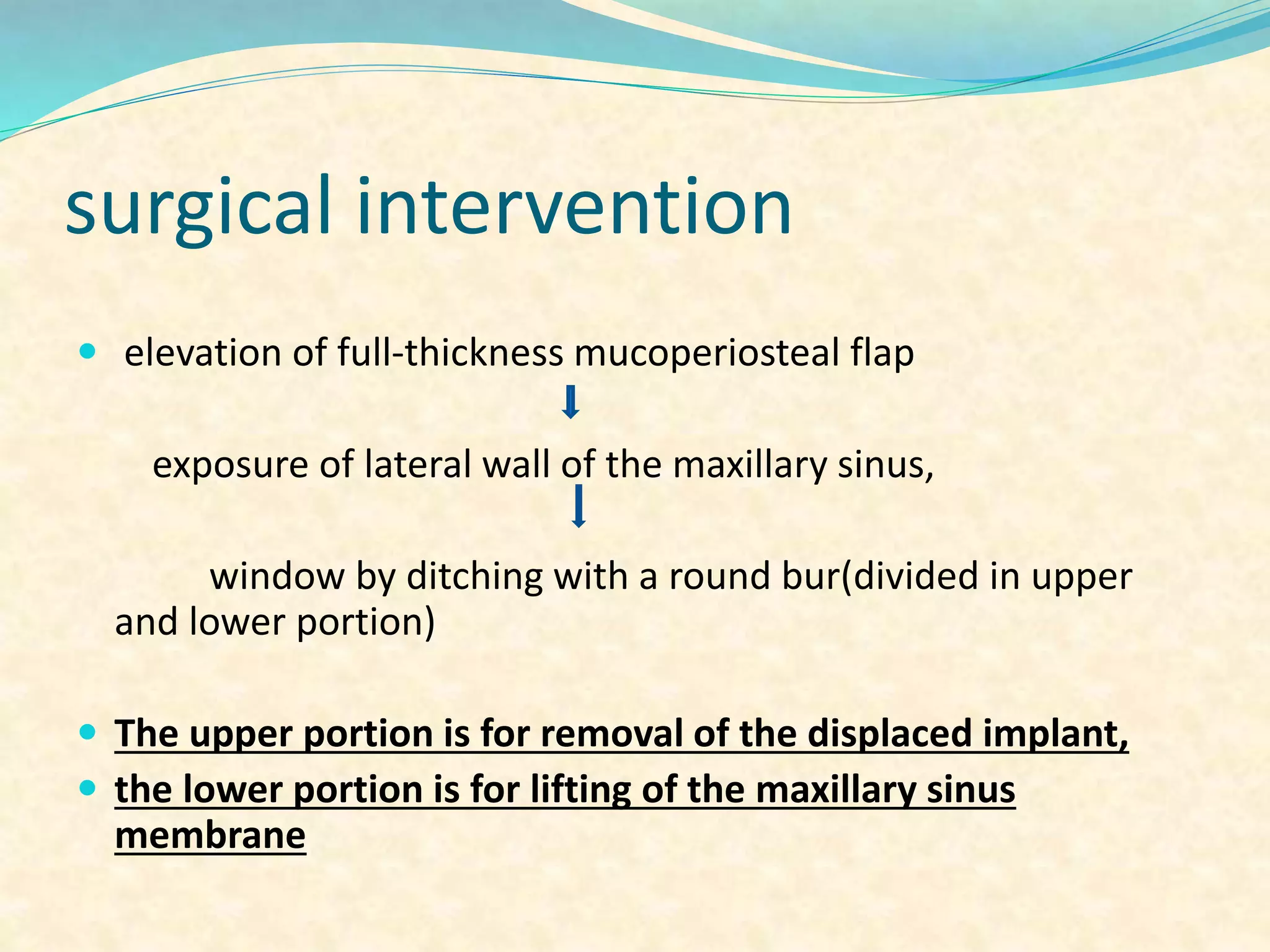 Treatment of dental implant displacement into the maxillary sinus | PPTX