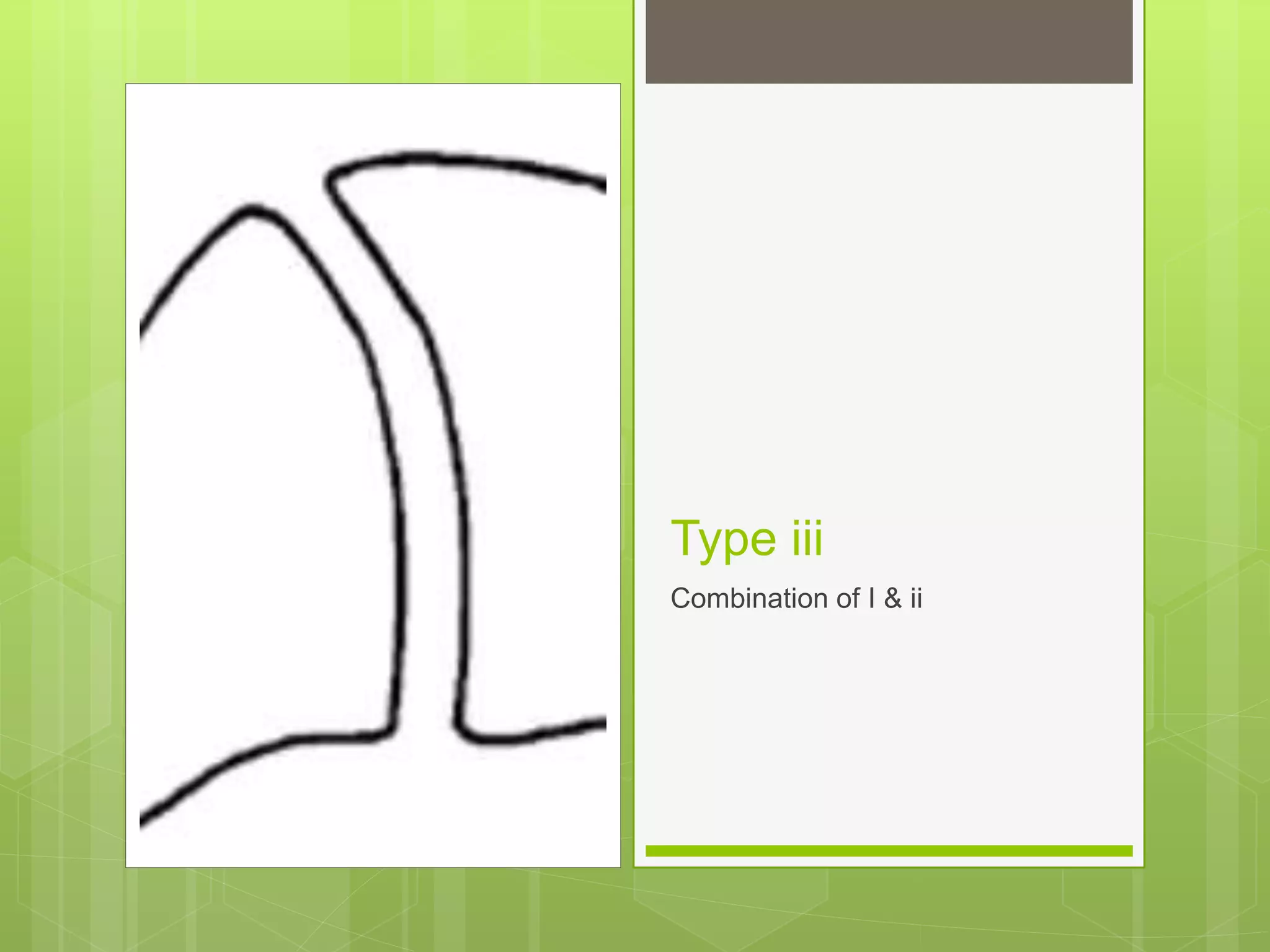 Maxillofacial congenital defect (part 1) | PPTX