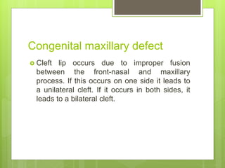 Maxillofacial congenital defect (part 1) | PPTX