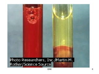 Tranexamic Acid "Maxna" (by gul nawaz khan) | PPT