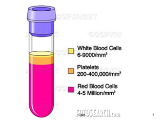 Tranexamic Acid "Maxna" (by gul nawaz khan) | PPT