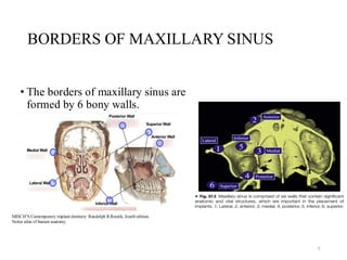 Maxillary sinus anatomy and sinus agumentation | PDF