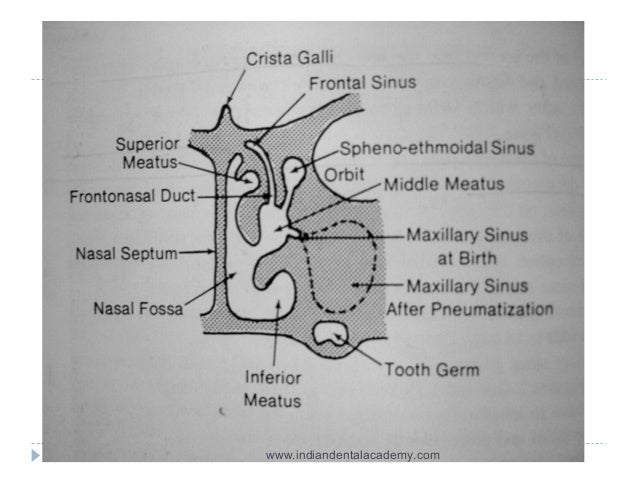 Maxillary Sinus Cavity Diagram