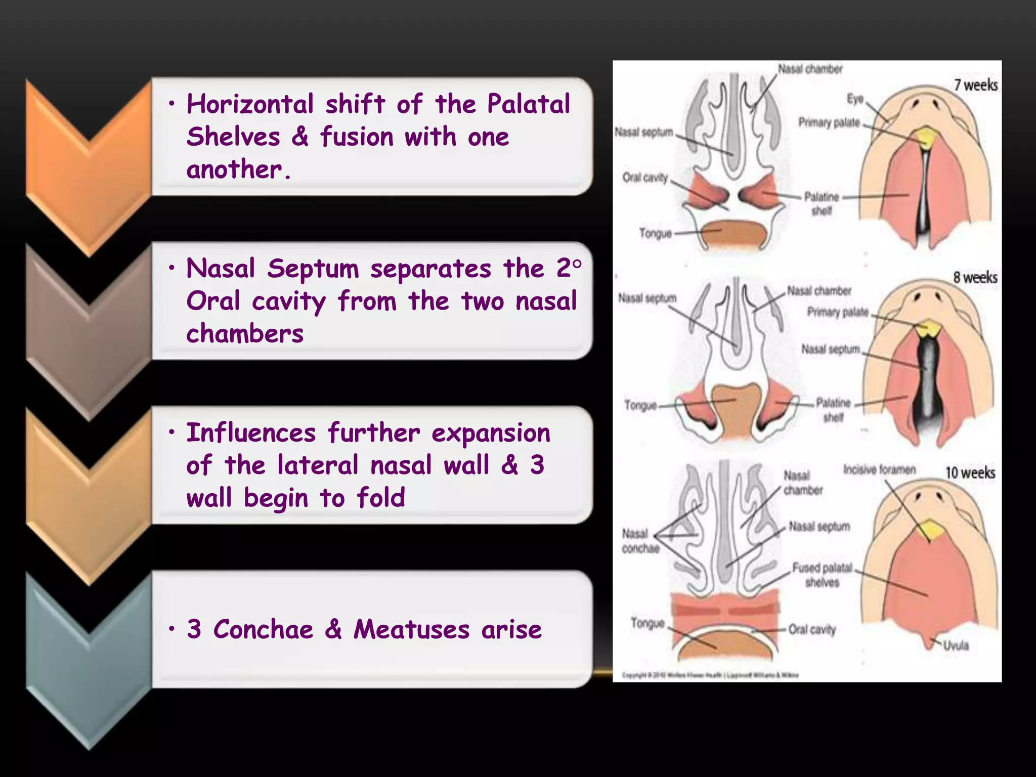 Maxillary sinus sinus | PPTX