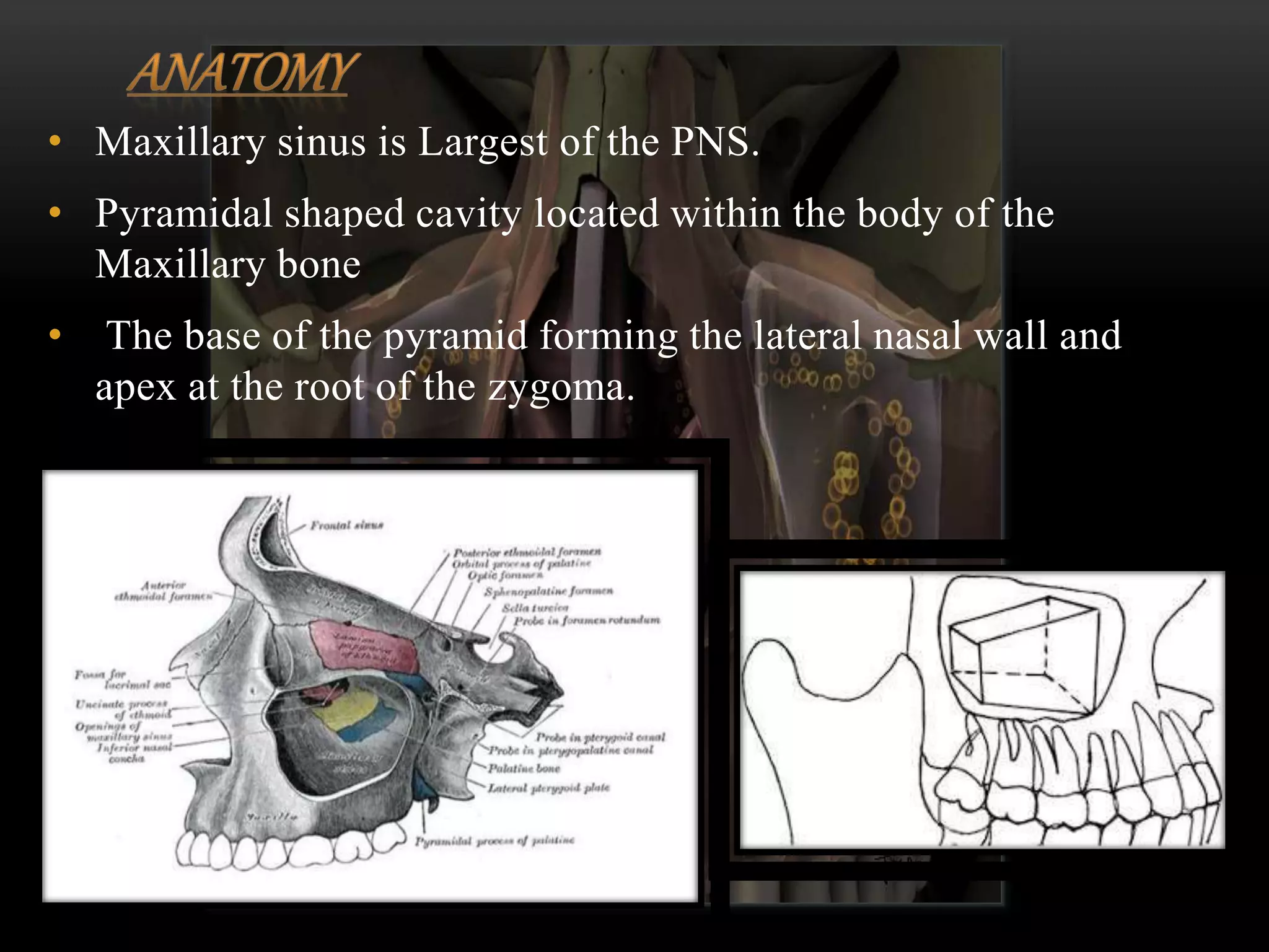 Maxillary sinus sinus | PPTX