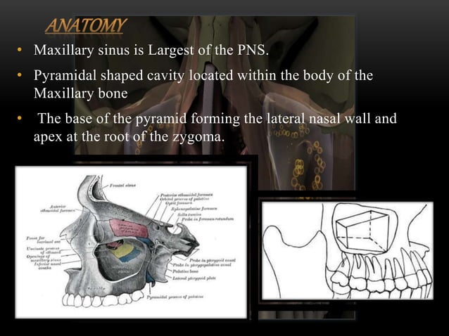 Maxillary sinus sinus | PPTX