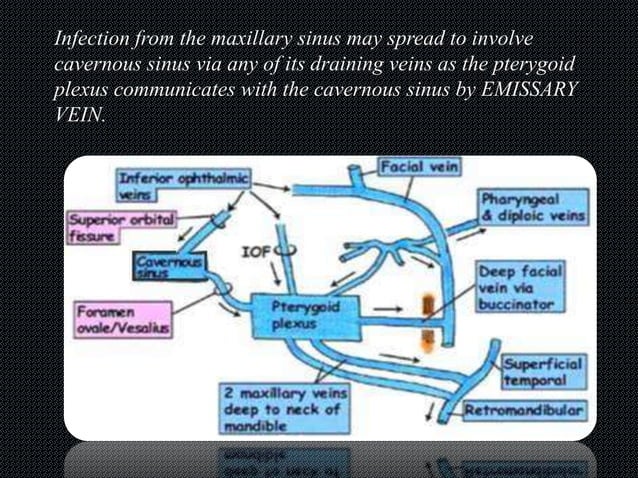 Maxillary sinus sinus | PPTX