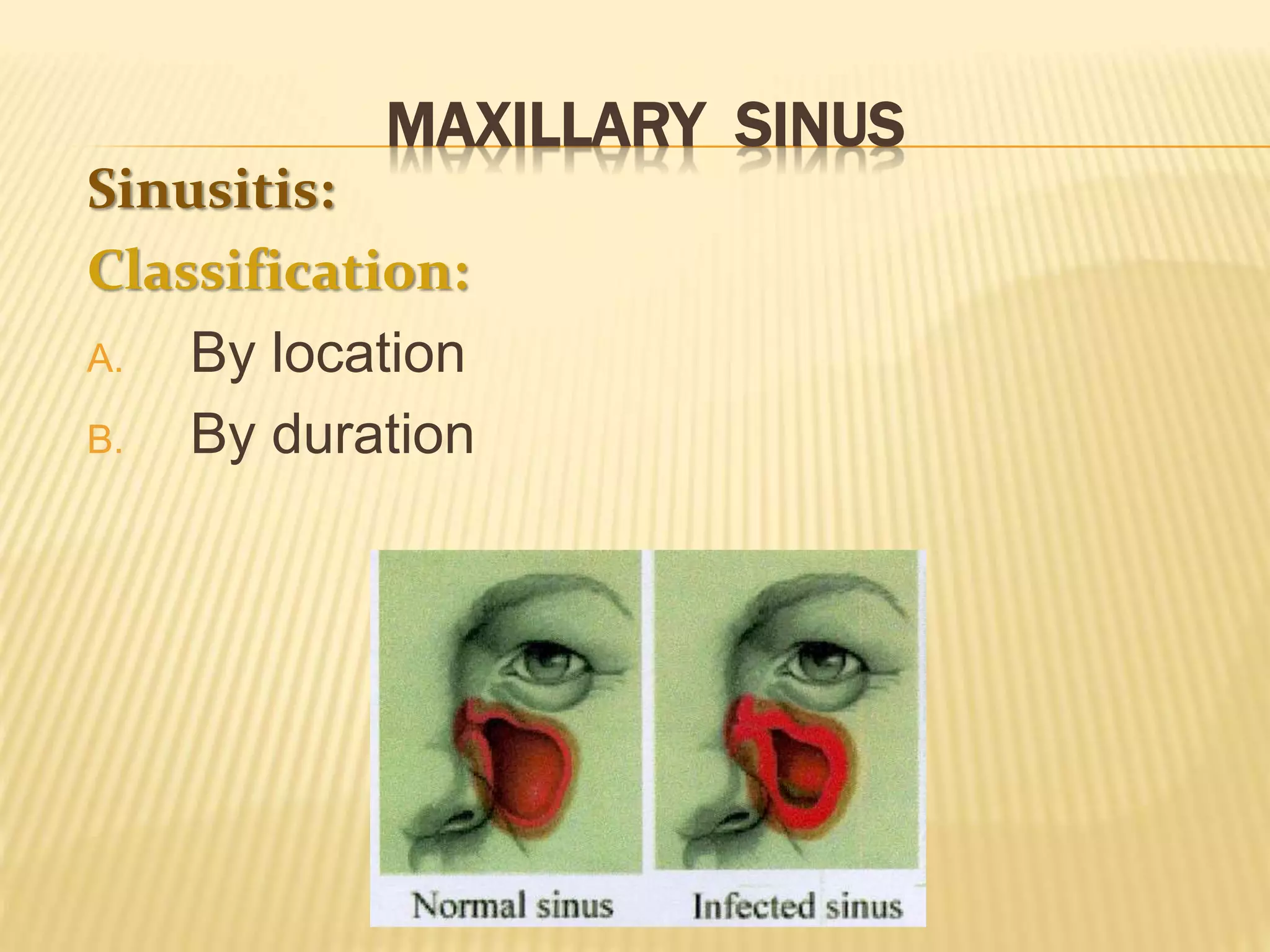 Max sinus smitha | PPT