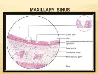 Max sinus smitha | PPTX | Ear, Nose and Throat Conditions | Diseases ...