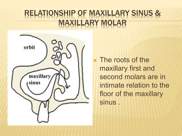 Max sinus smitha | PPT