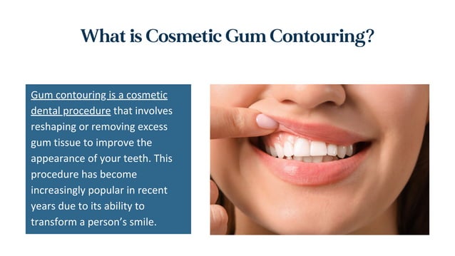 7 Advantages Of Cosmetic Gum Contouring.pdf
