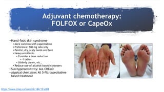 Managing the Digestive Side Effects of Colorectal Cancer | PPT